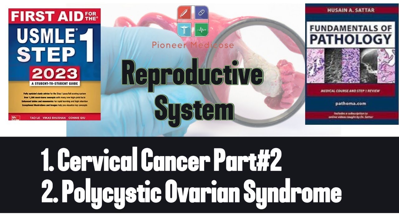 USMLE step 1|Cervical carcinoma, PCOS from First Aid|Reproductive ...