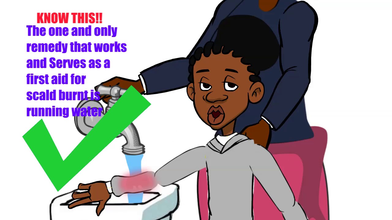 FIRST AID FOR SCALD BURNT - 2D CARTOON - YouTube