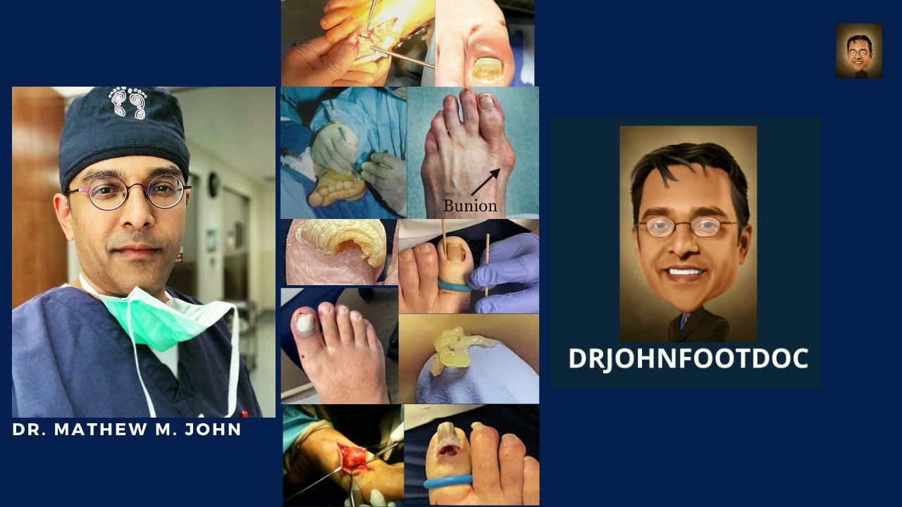 Welcome to The DRJOHNFOOTDOC YouTube Channel ! Dr. John is a podiatrist ...