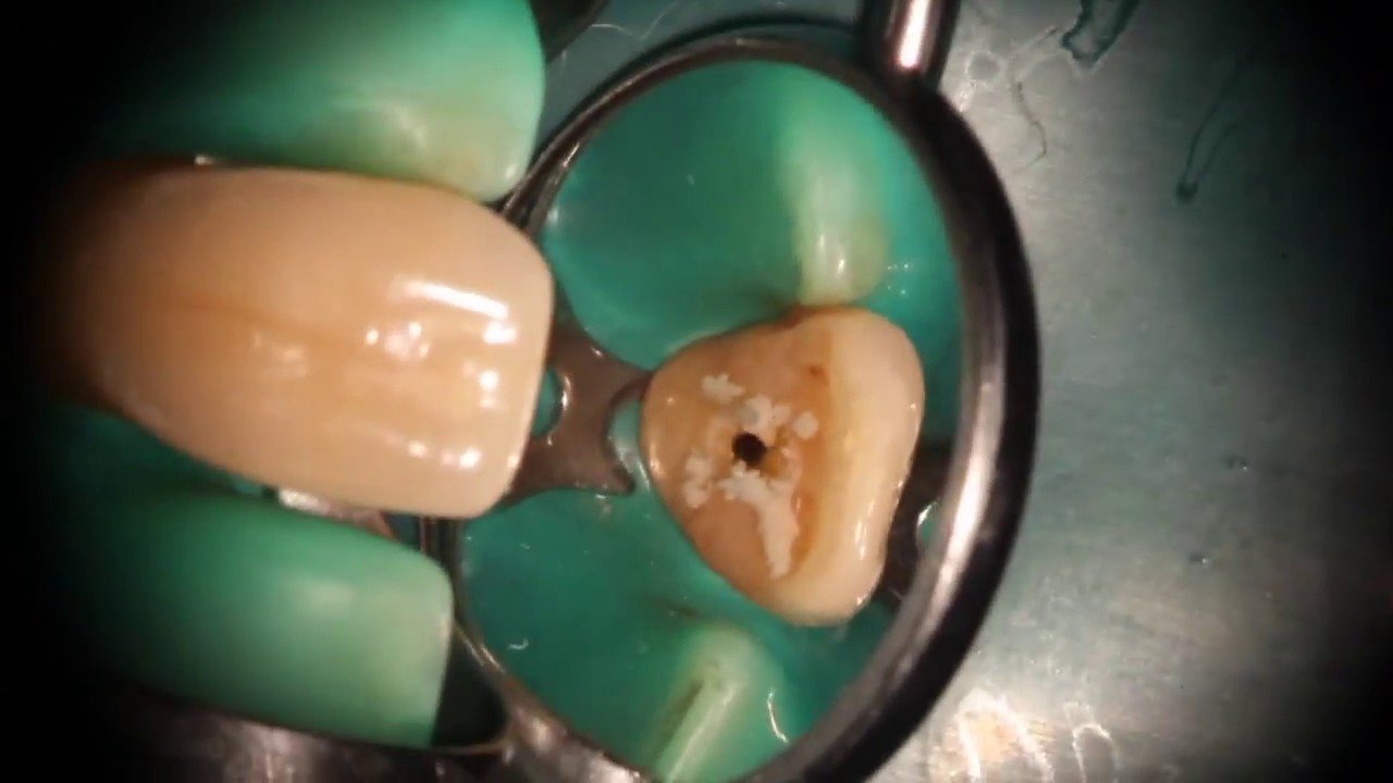 2Shape MICRO-MEGA - YouTube