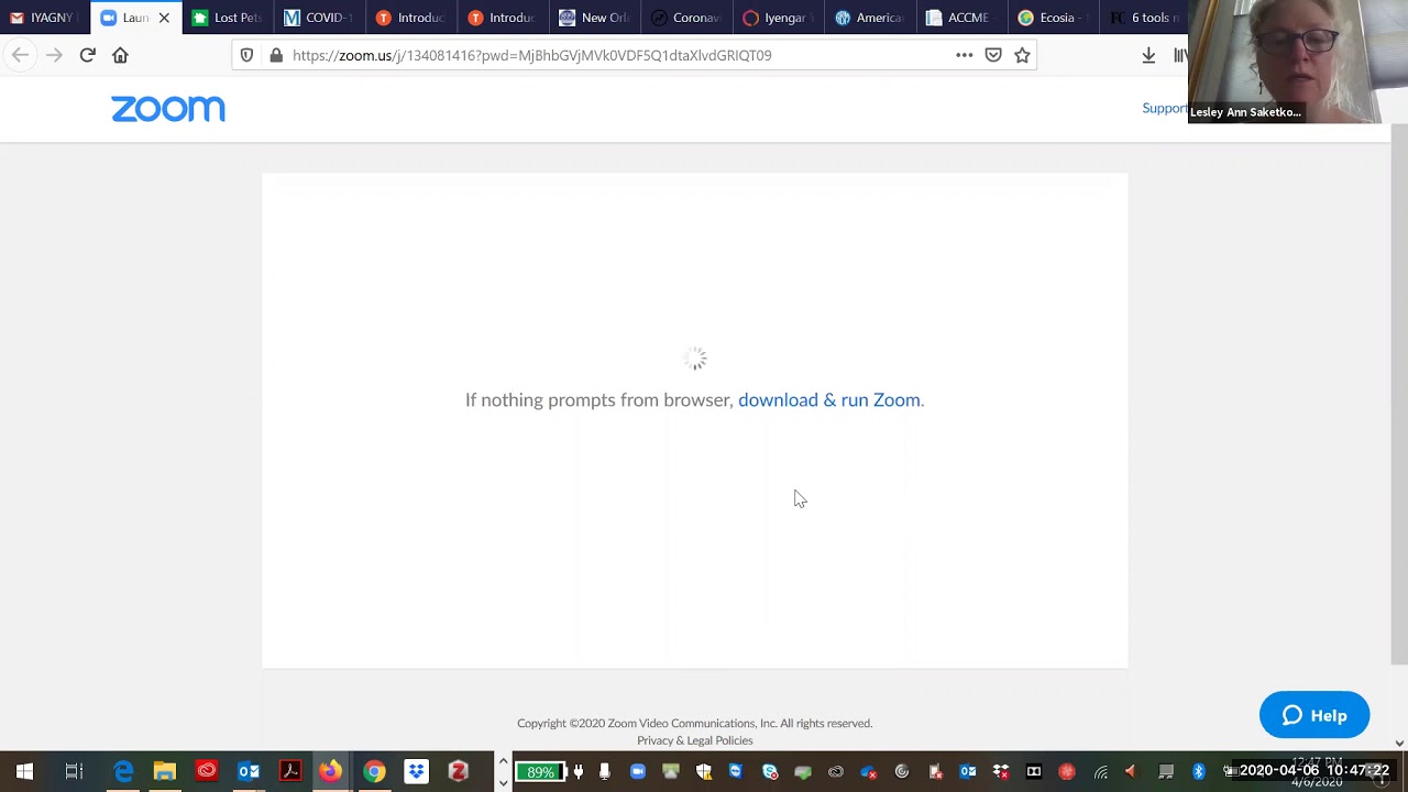 Patient Support Group Zoom Connection Instructions - YouTube