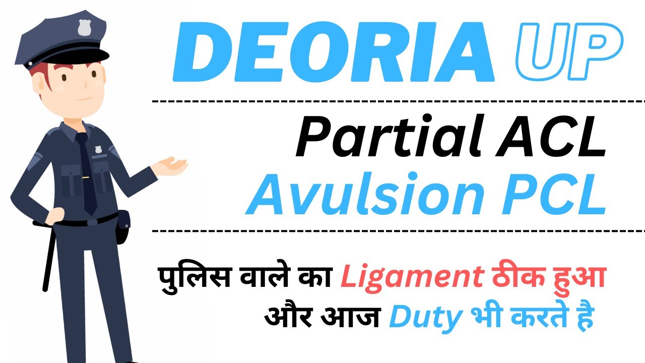 Deoria (UP) Ligament ठीक कैसे हुआ Police Man का ??? - YouTube