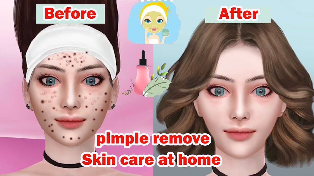 How to pimple remove & skin care at home!! ASMR 3D Animation - YouTube