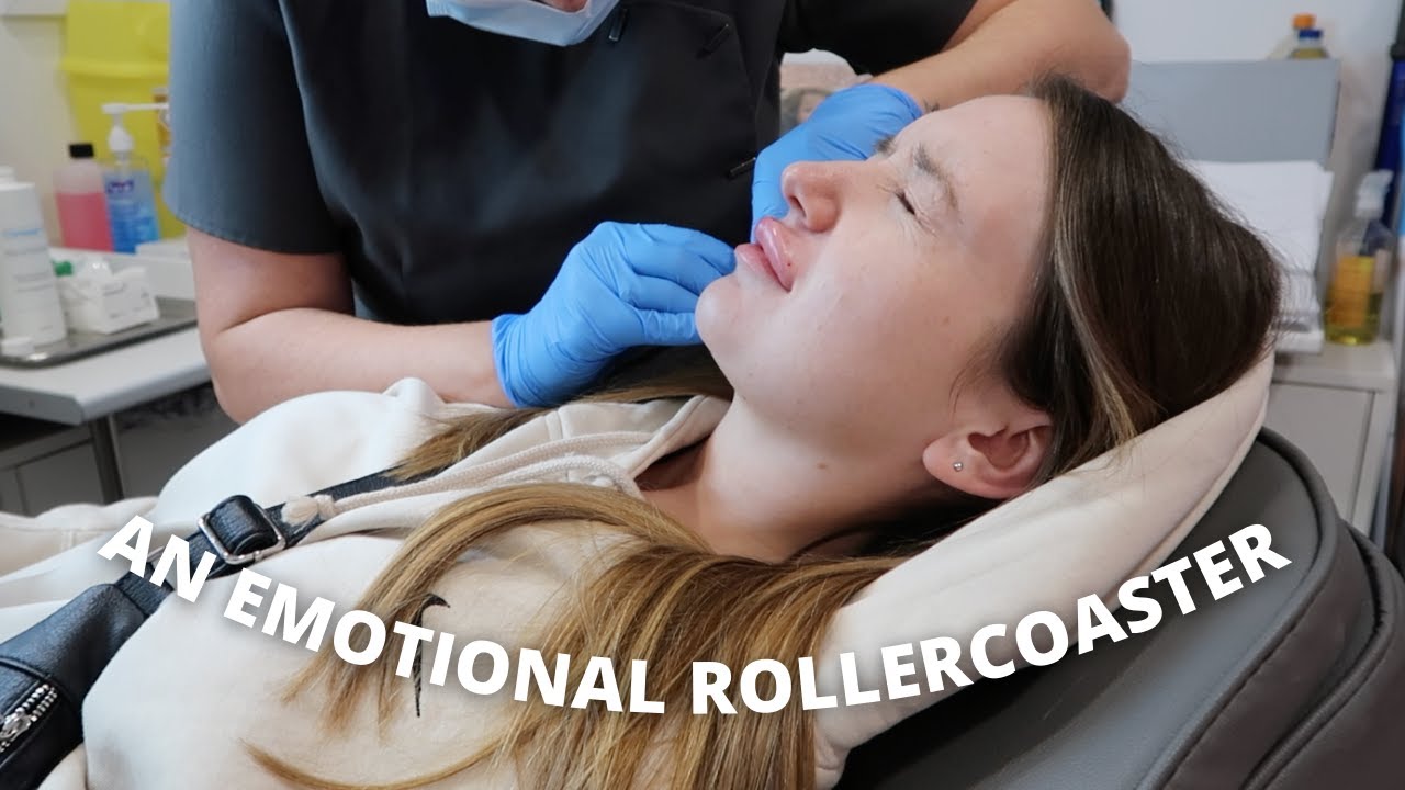 THE PROCESS OF GETTING MY LIP FILLERS DISSOLVED & REFILLED - YouTube