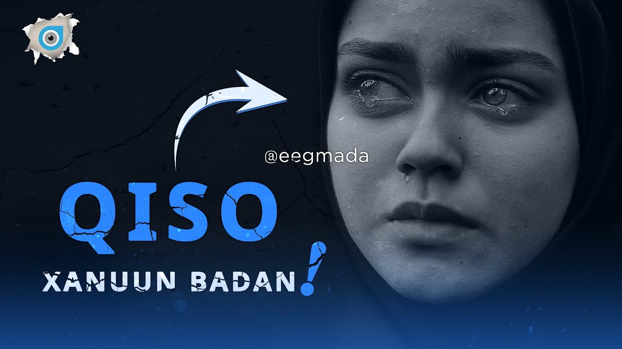 Qiso Xanuun Badan oo Murugo leh 😢| Eegmada - YouTube