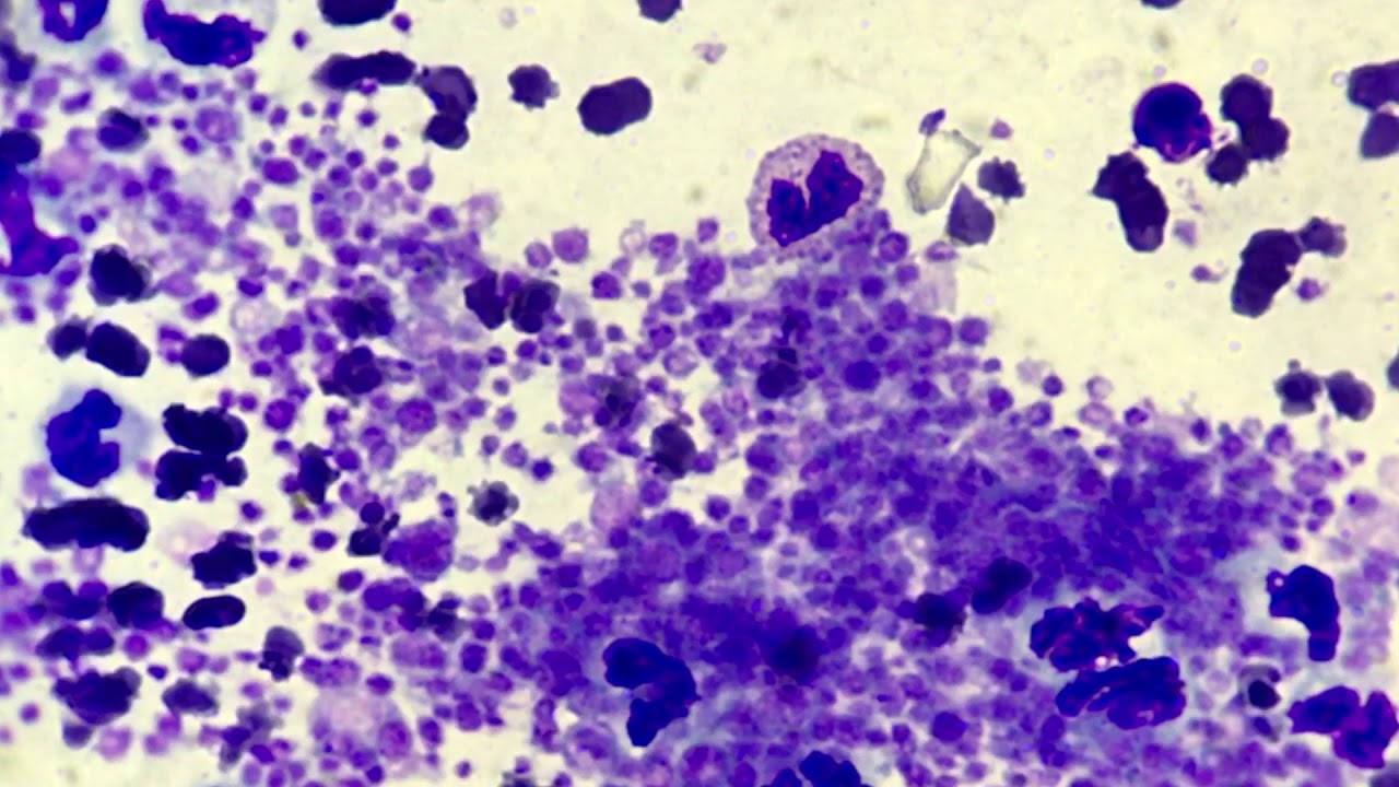 Platelet aggregates | feline blood smear - YouTube