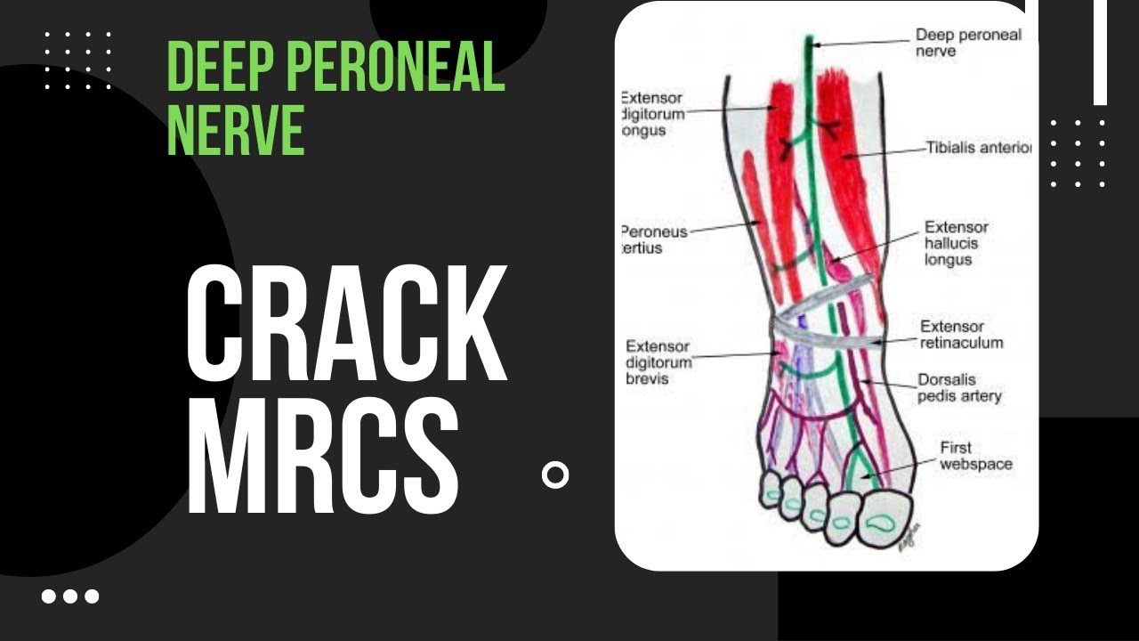 Deep peroneal nerve MRCS question solve - YouTube