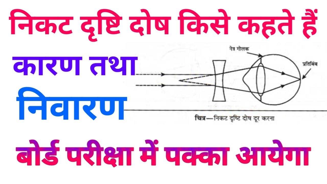 निकट दृष्टि दोष किसे कहते हैं।। nikat Drishti dosh kya hai।। nikat ...