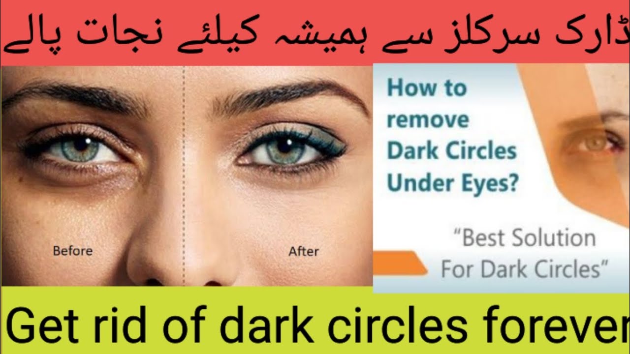 How to get rid of dark circles l Dark circles ko kaise khatam kare l ...