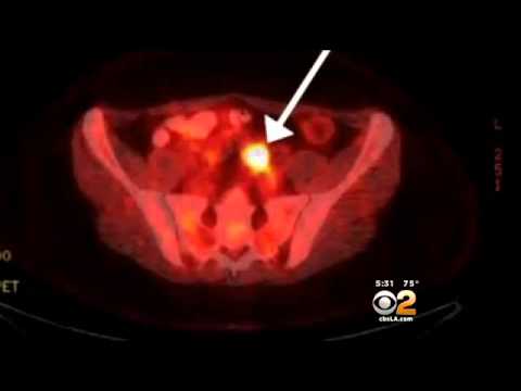 Cervix Tattoos