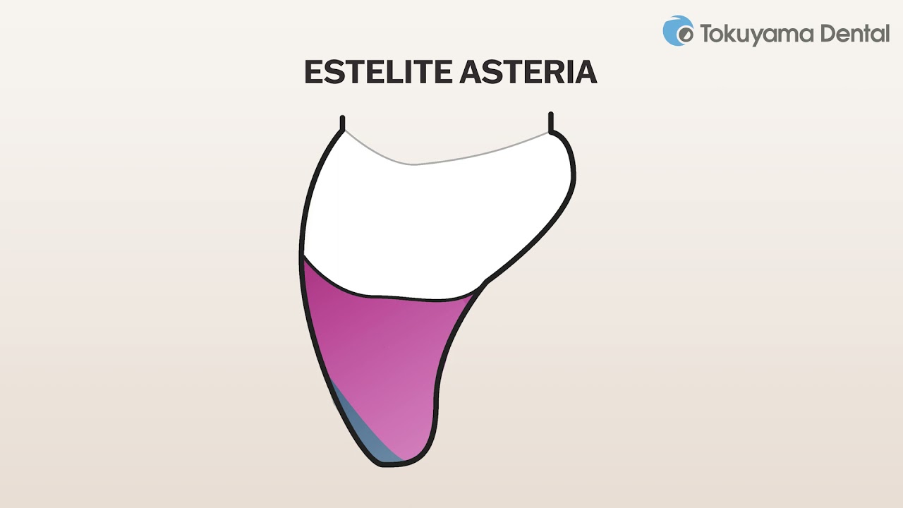 ESTELITE ASTERIA from TOKUYAMA DENTAL - YouTube