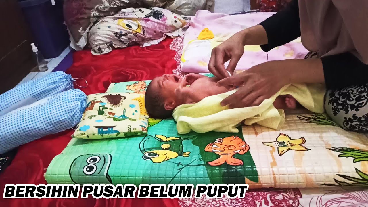 CARA BERSIHIN PUSAR (UDEL) BAYI SEBELUM PUPUT - YouTube