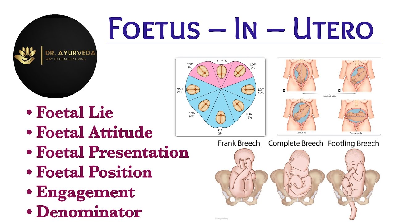 Foetus | Foetus in utero | Lie | Attitude| Presentation | Position ...