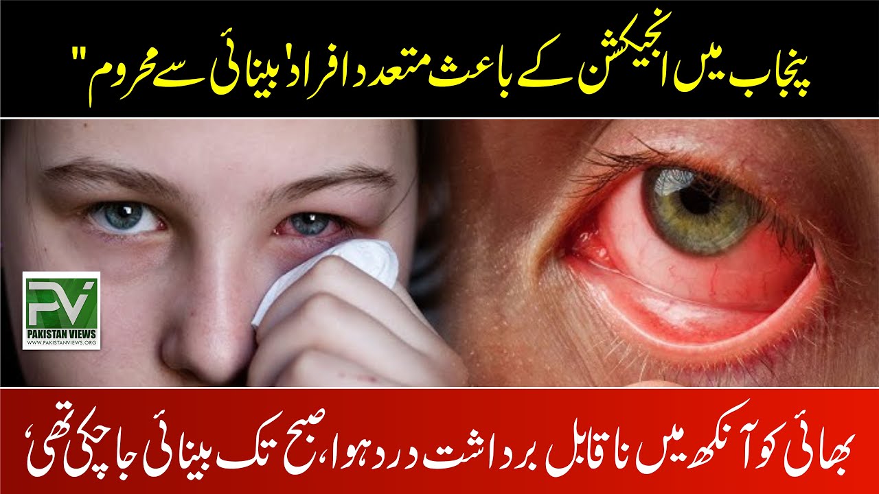 Several People 'Lose sight' Due to Injection In Punjab || Eyes Virus in ...