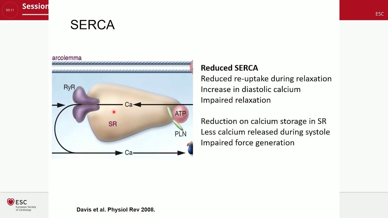 Pathophysiology of HFpEF, HFrEF, and HFmEF - YouTube