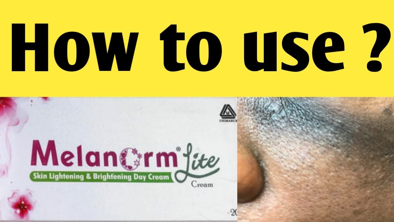 Melanorm lite Cream 👸 चेहरे के काले दाग-धब्बे कैसे हटाए ? MELANORM LITE ...