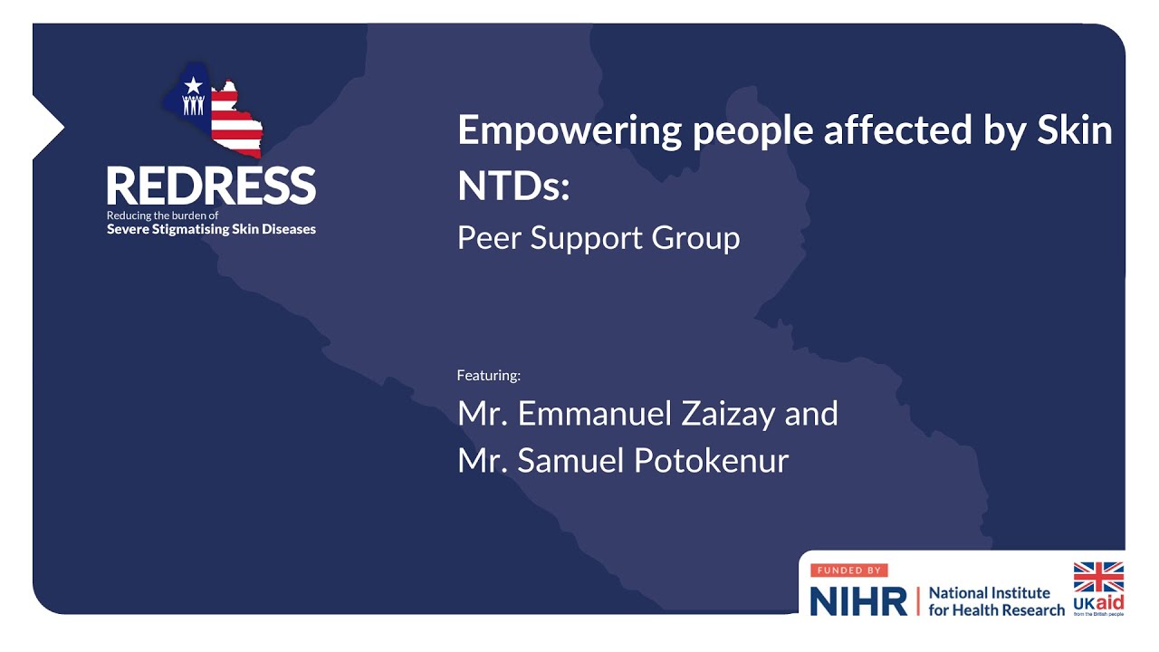 Empowering people affected by skin NTDs - YouTube