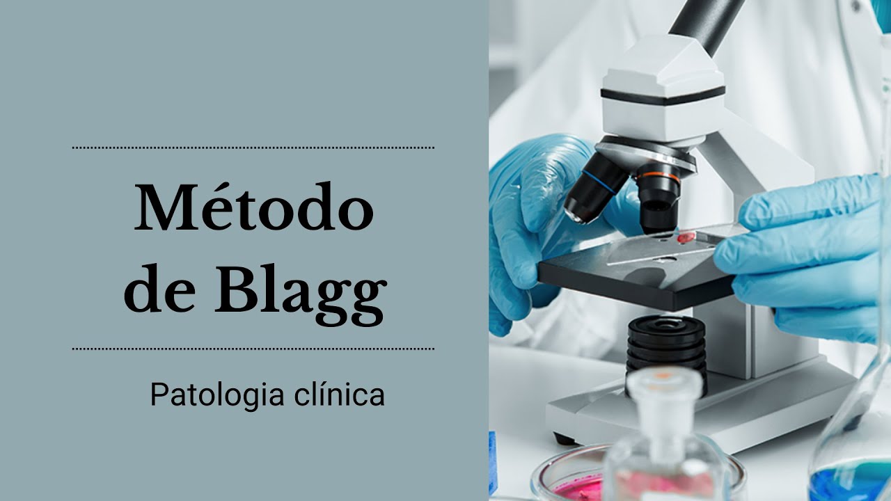 Patologia Clínica - Método de Blagg - YouTube