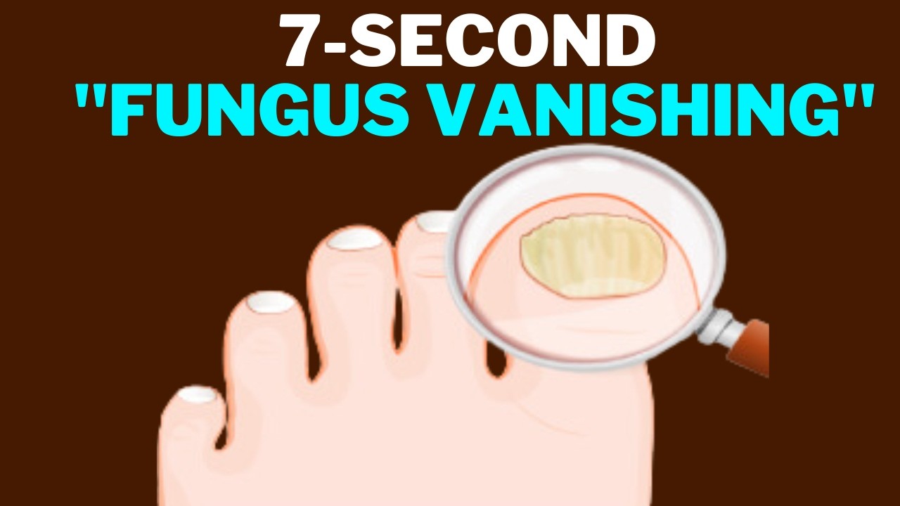 1 Dab of THIS May End Fungus Problems Even When You Sleep - YouTube