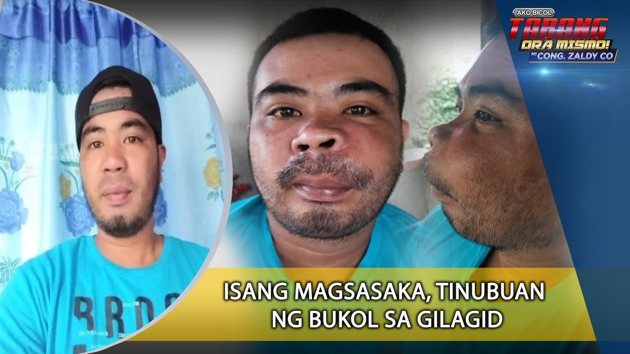 Isang magsasaka, tinubuan ng bukol sa gilagid - YouTube