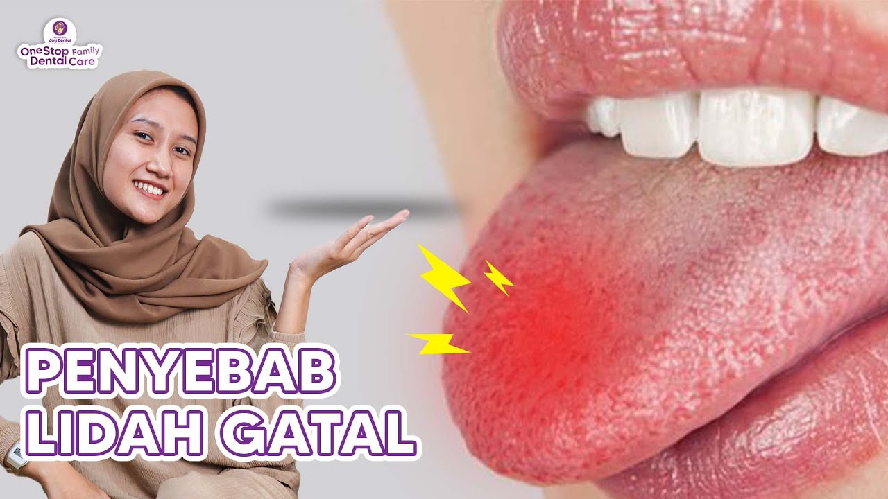 GATAL DI LIDAH? APA PENYEBABNYA DAN GIMANA PENANGANANNYA? - YouTube