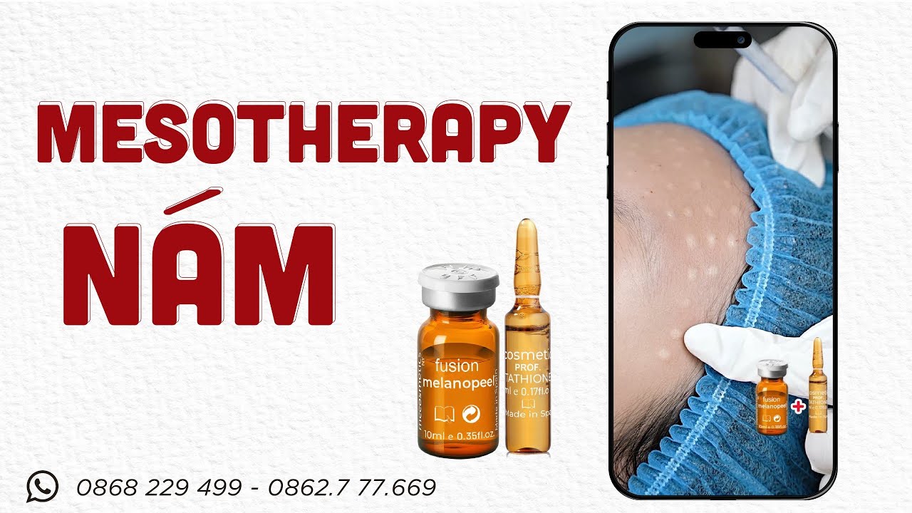 [MESOTHERAPY NÁM] QUY TRÌNH MIX THUỐC -TRỘN THUỐC VÀ TIÊM MESO NÁM ...