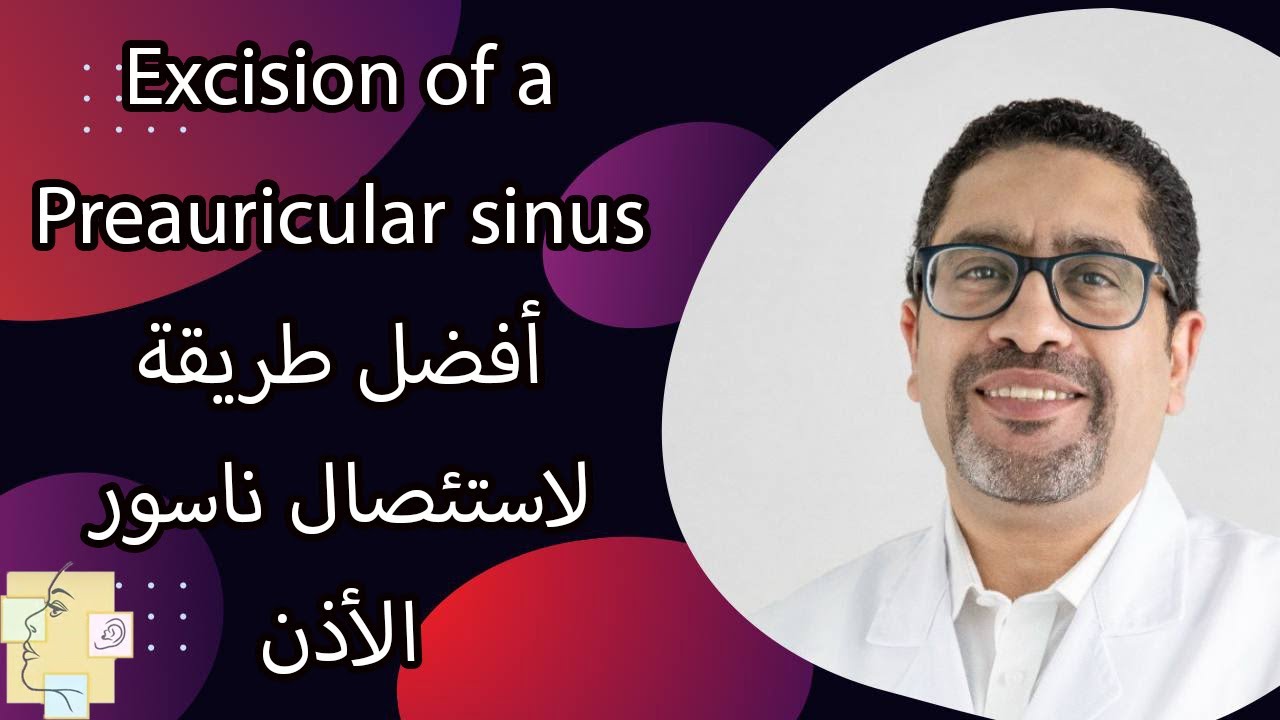 Excision of a Preauricular sinus أفضل طريقة لاستئصال ناسور الأذن - YouTube