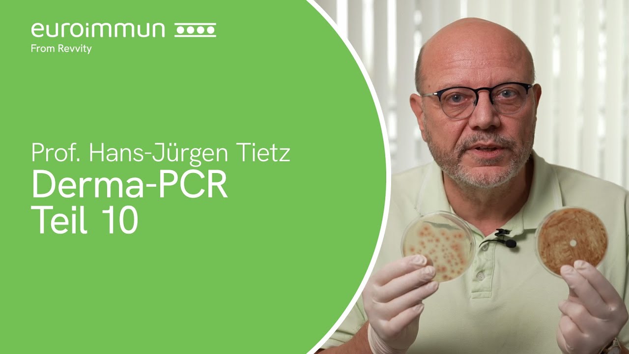 Klinik und Diagnostik neuer Pilzerreger - YouTube