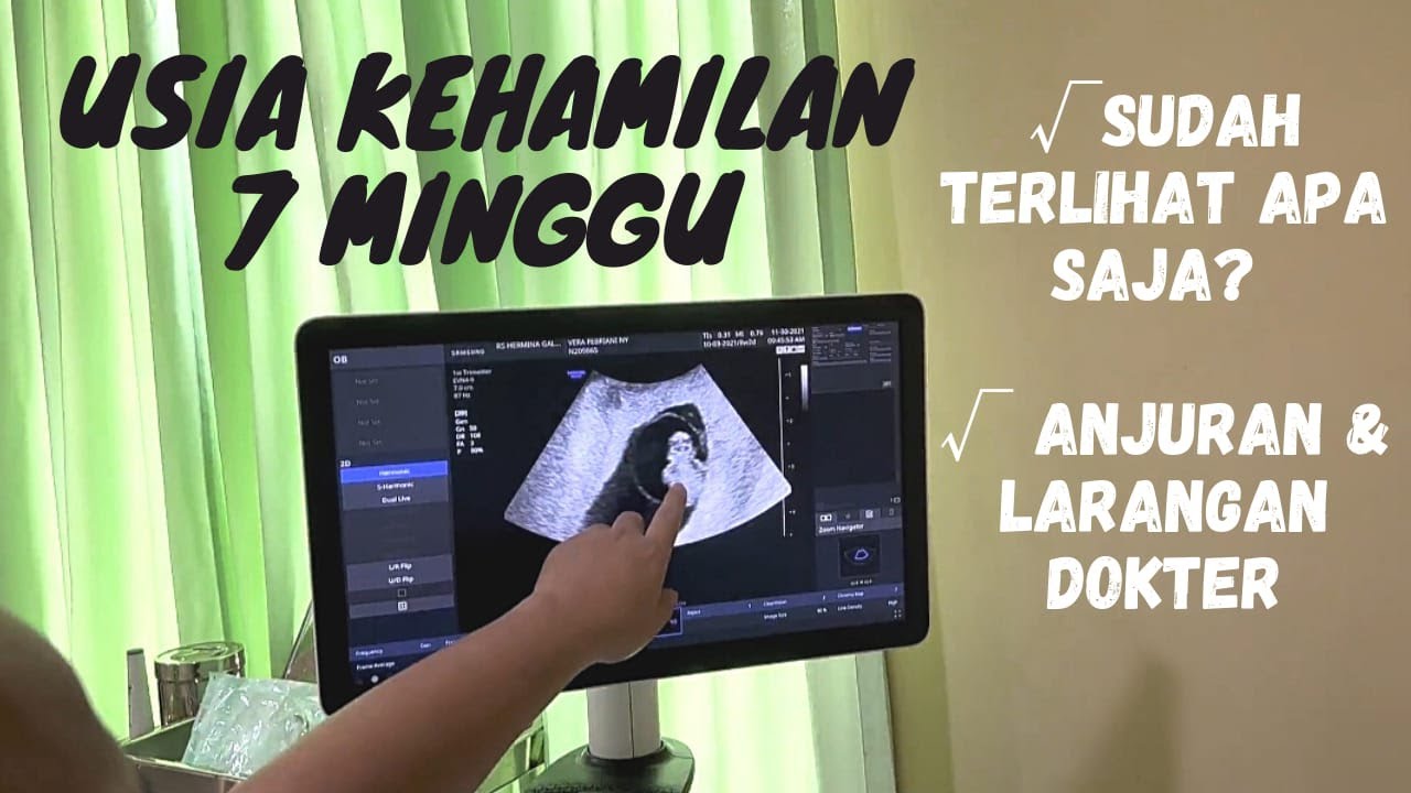 HASIL USG BAYI 7 MINGGU | USG 1-2 BULAN | USG TRIMESTER 1 ...