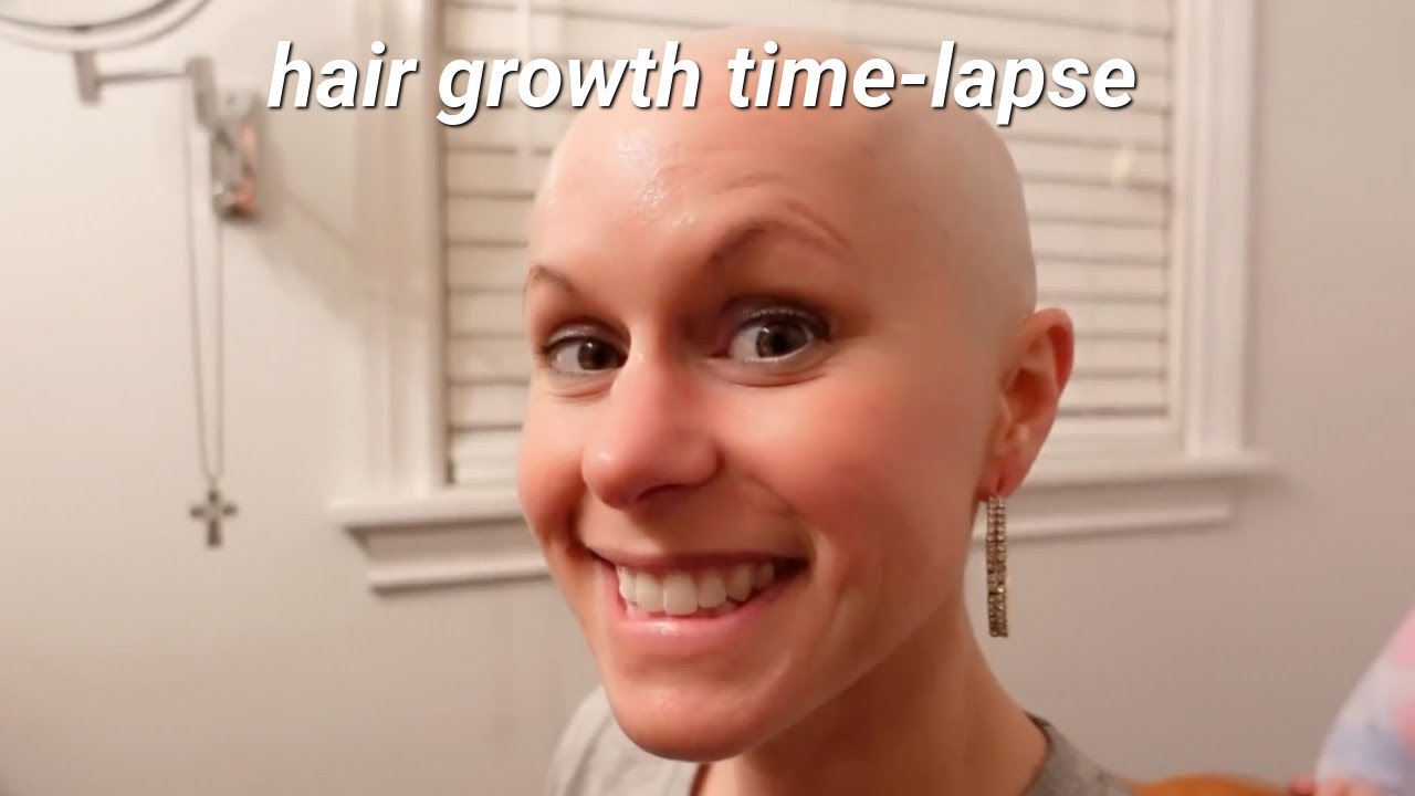 Completely BALD 1 Year Timelapse Hair Growth - YouTube