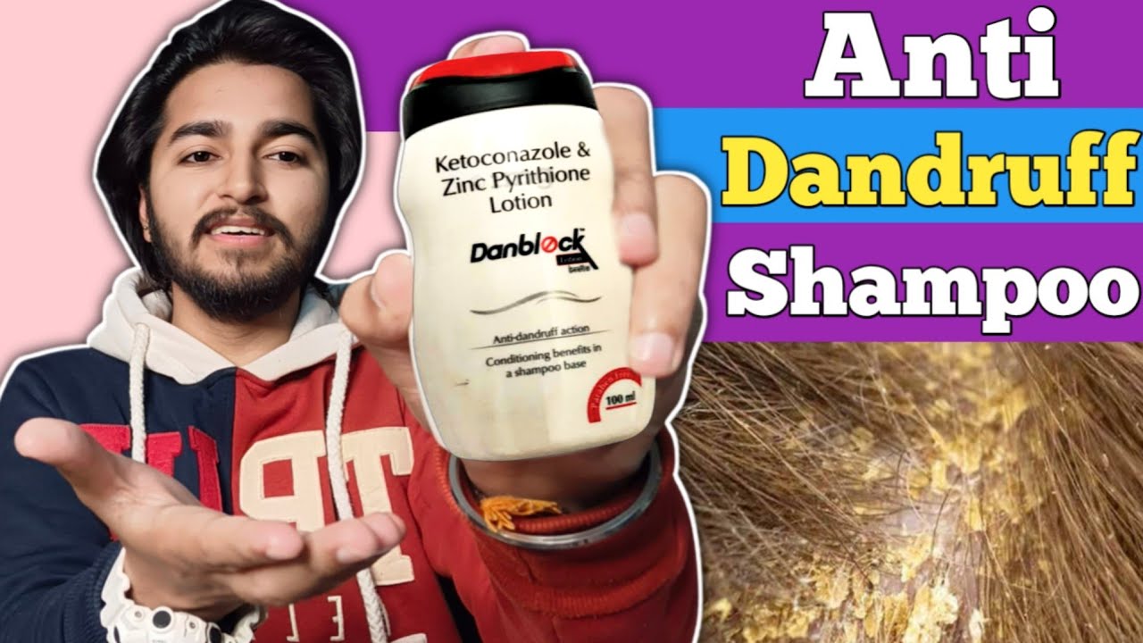 Danblock Anti Dandruff Shampoo Review in Hindi | Shampoo For Dandruff Itchy Scalp - YouTube