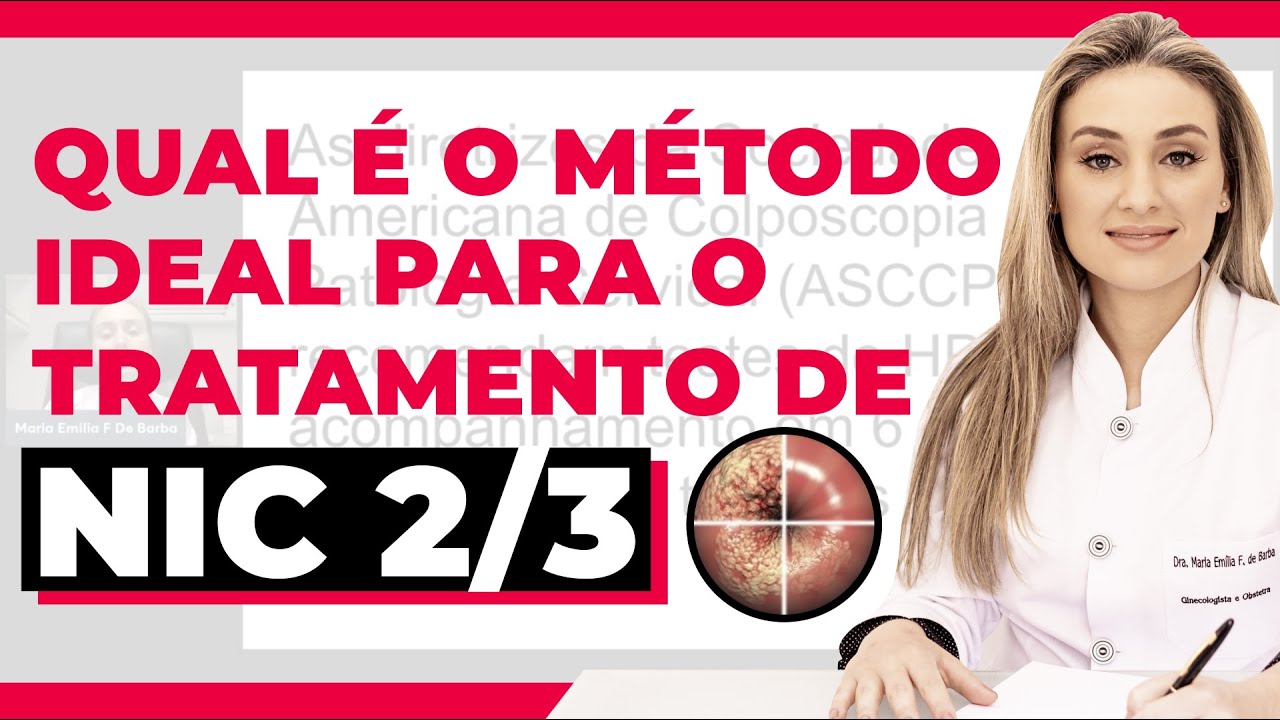 Qual é o método ideal para o tratamento de NIC 2/3? - YouTube