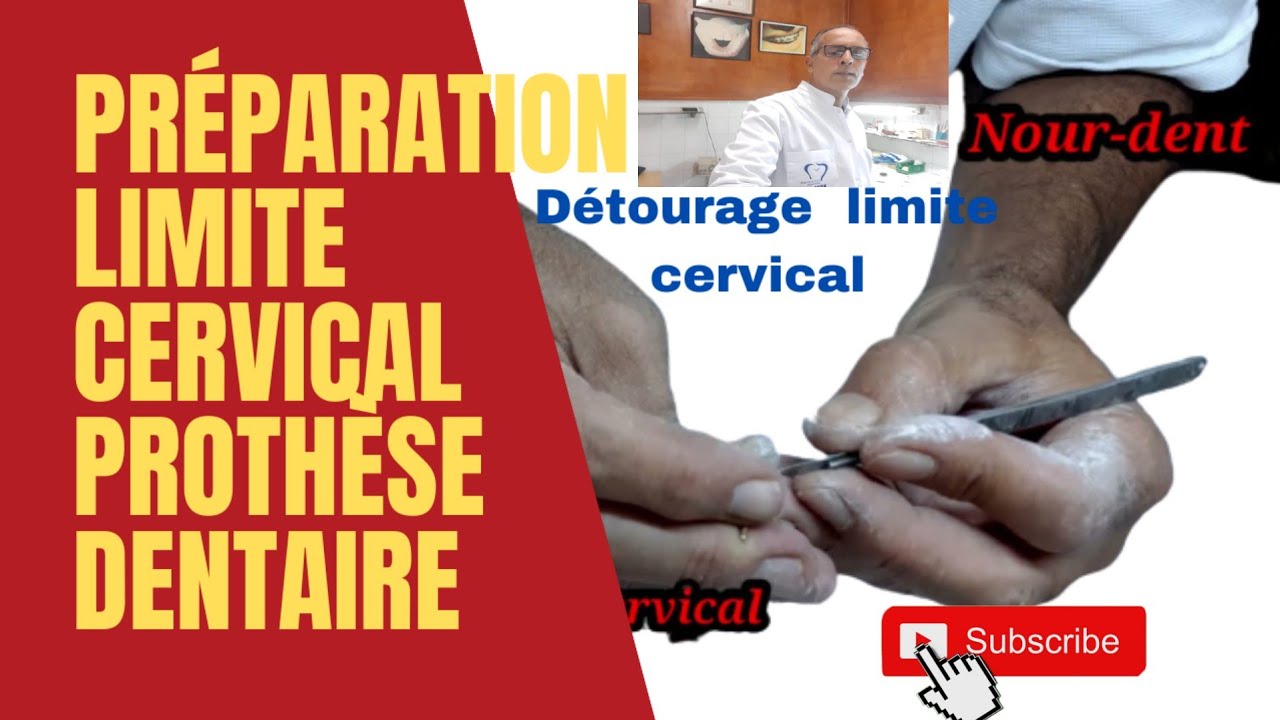 préparation du limite cervical prothèse dentaire. Détourage limite ...