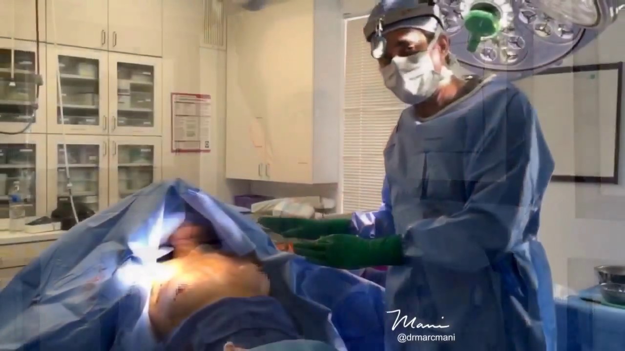 Breast fat transfer - YouTube