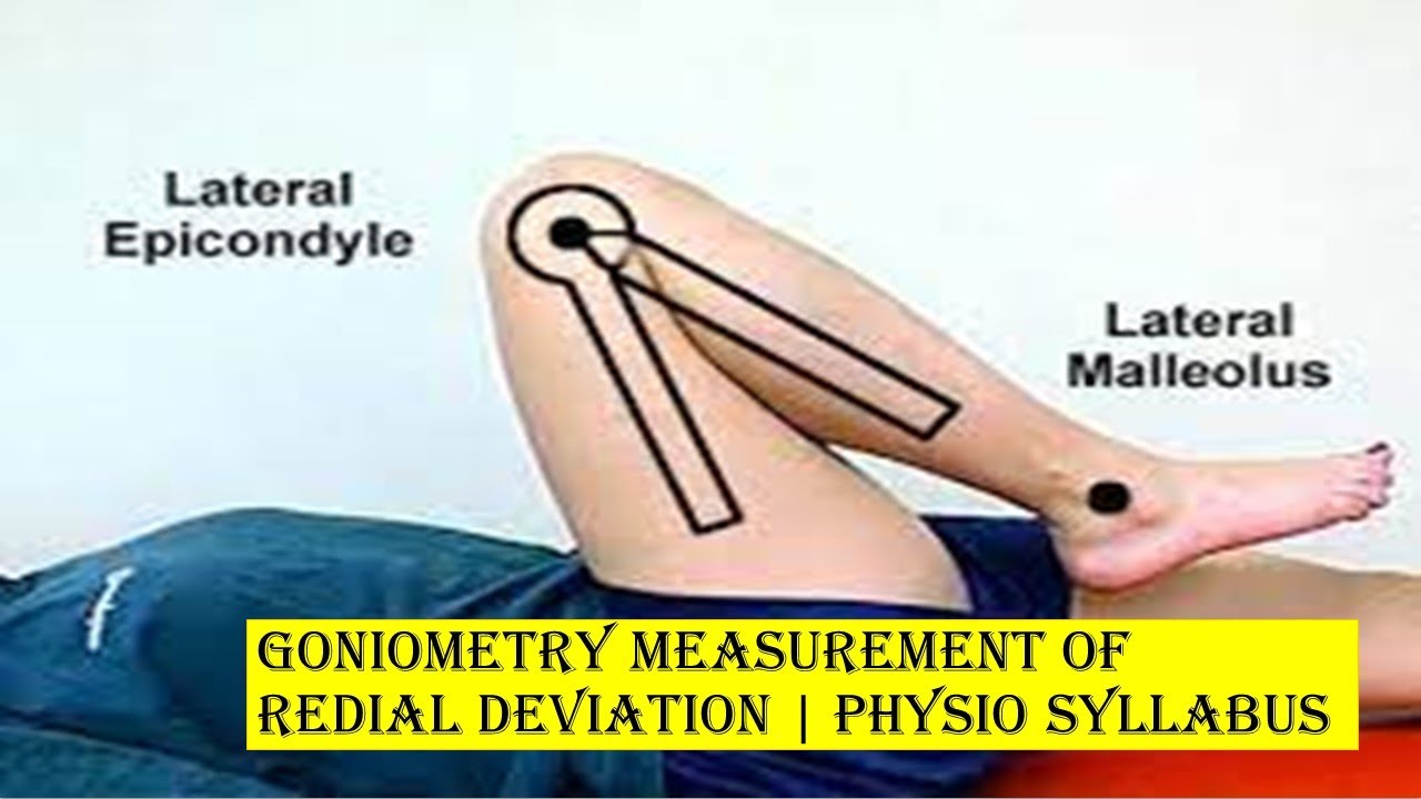 How to get Goniometry Measurements | Physio Syllabus - YouTube