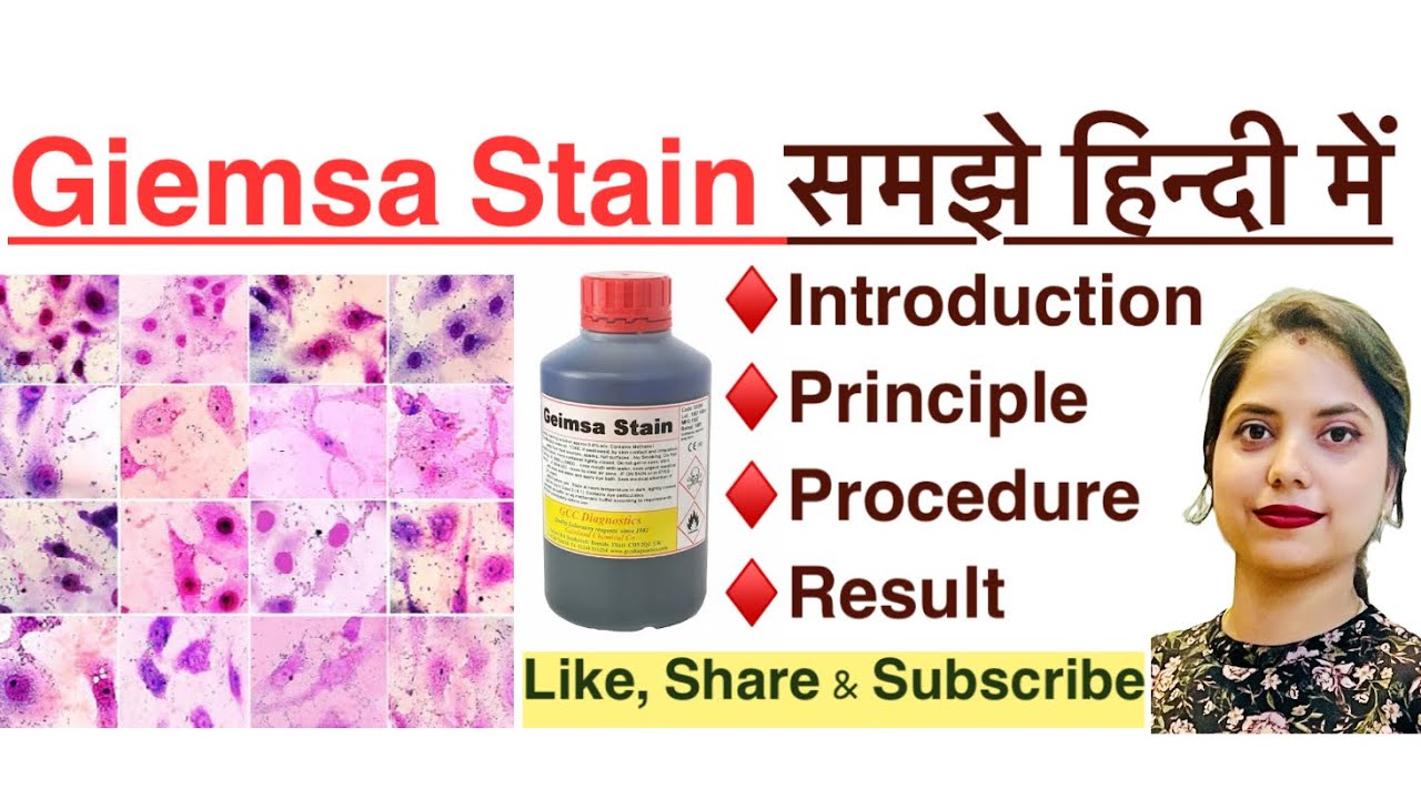 Giemsa stain in Hindi | principle | procedure | result | MLT ...