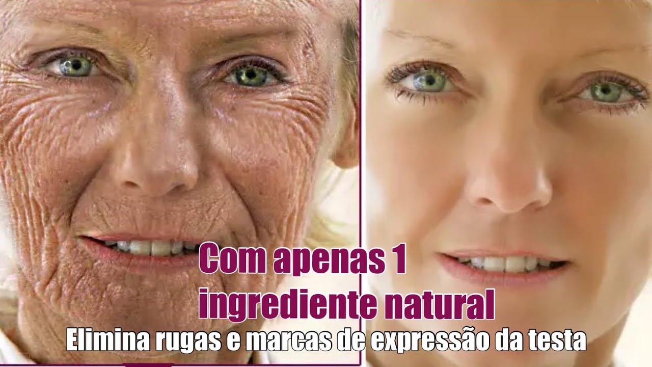 COM APENAS 1 INGREDIENTE NATURAL ELIMINA RUGAS E MARCA DE expressões da ...