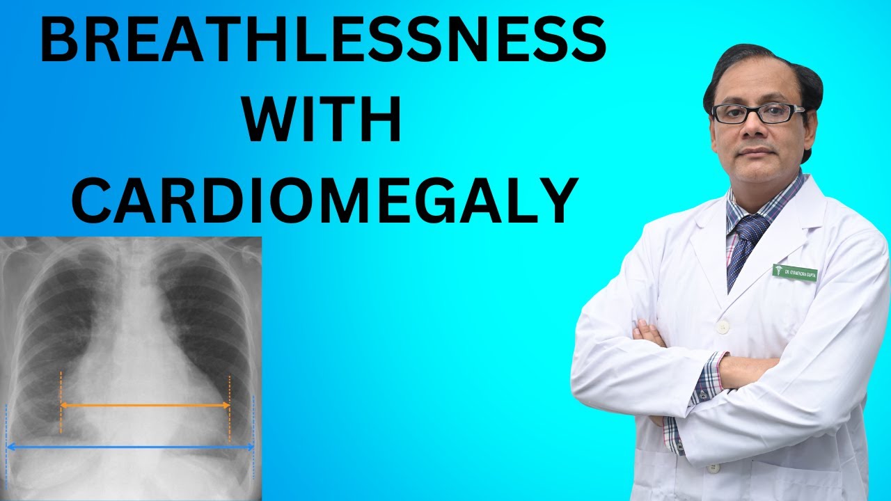 Breathlessness with cardiomegaly - YouTube