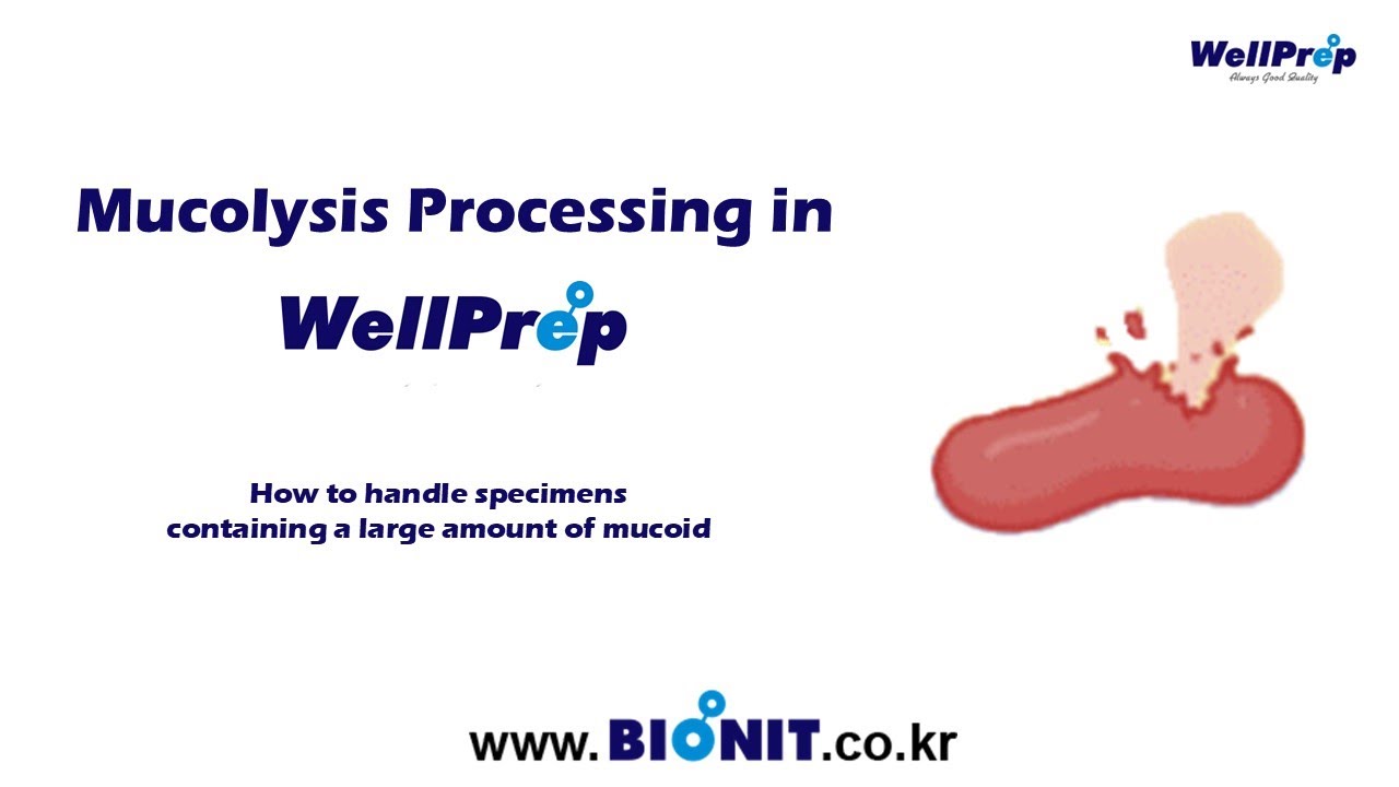 Mucolysis Processing in WellPrep Liquid-based Cytology of Bionit Inc ...