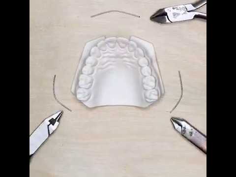 How is it Made? The Retainer! - YouTube