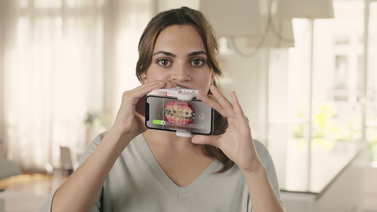 How to scan with your ScanBox Pro (braces) - YouTube