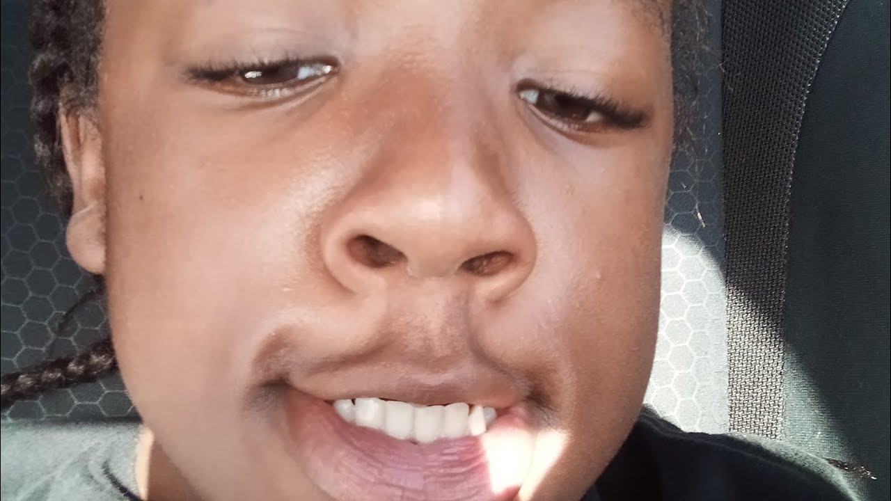 black monkey has autism - YouTube