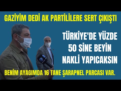GAZİYİM DEDİ AK PARTİLİLERE SERT ÇIKIŞTI.TÜRKİYE'DE YÜZDE 50 SİNE BEYİN NAKLİ YAPACAKSIN.