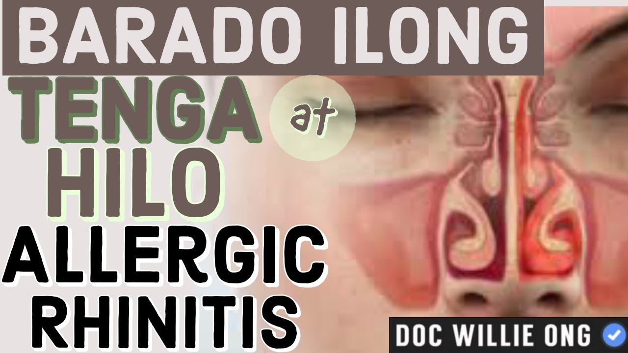Barado Ilong, Tenga at Hilo: Allergic Rhinitis – by Doc Willie Ong ...