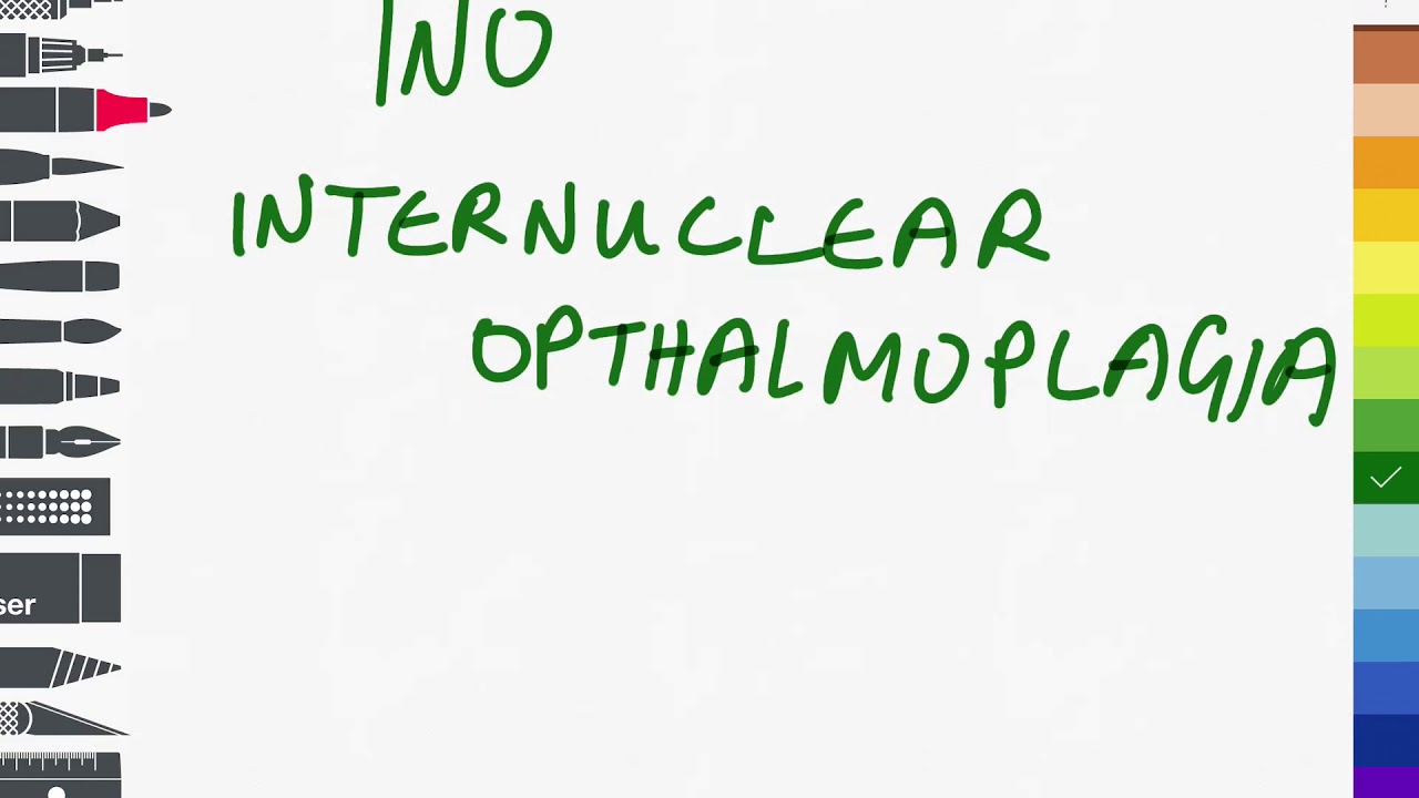 Internuclear Ophthalmoplagia - USMLE Step 1 - YouTube