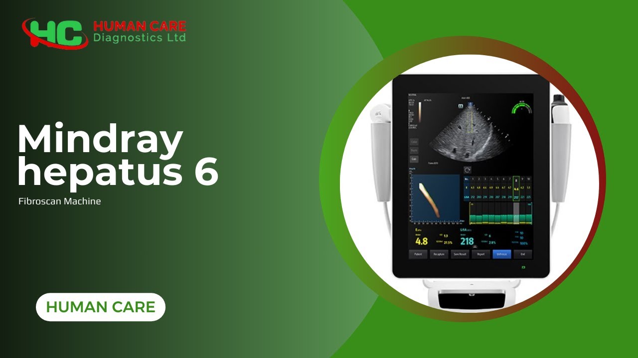 Mindray hepatus 6 Fibroscan Machine | Human Care Diagnostics Ltd - YouTube