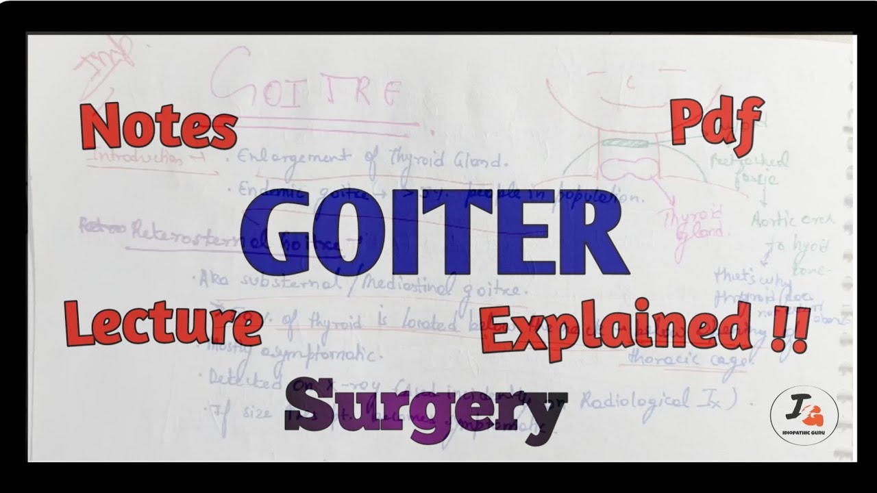 Goiter Surgery - YouTube