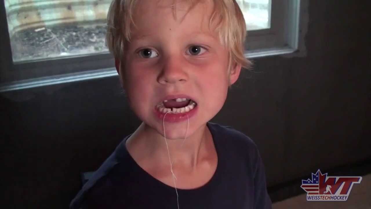 Tyler Shoots his Tooth Out with a Slap Shot - YouTube