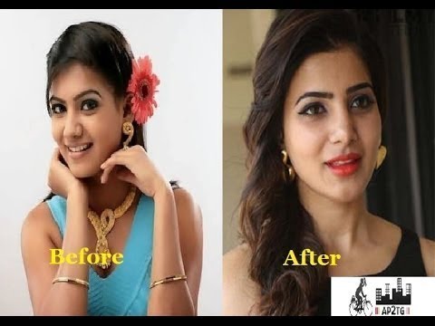 samantha ruth prabhu before and after plastic surgery telugu latest ...
