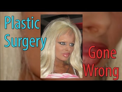 Plastic Surgery Gone Wrong - PSC Uncut - Ep.10 - YouTube